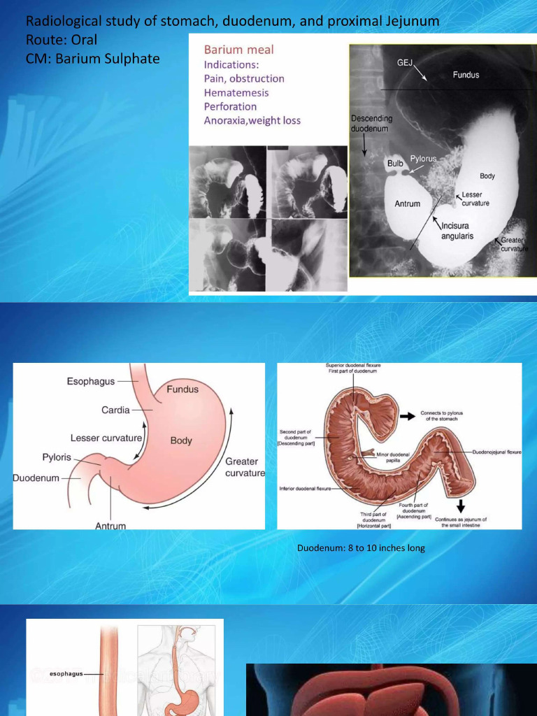 Barium Meal | PDF