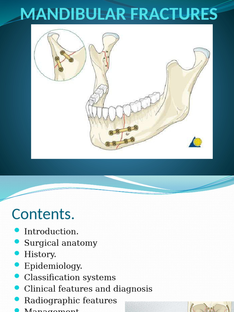 Mandibular Fracture Class | PDF | Medical Specialties