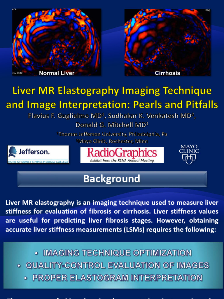 MR Elastography for Liver Stiffness Evaluation | PDF | Cirrhosis ...