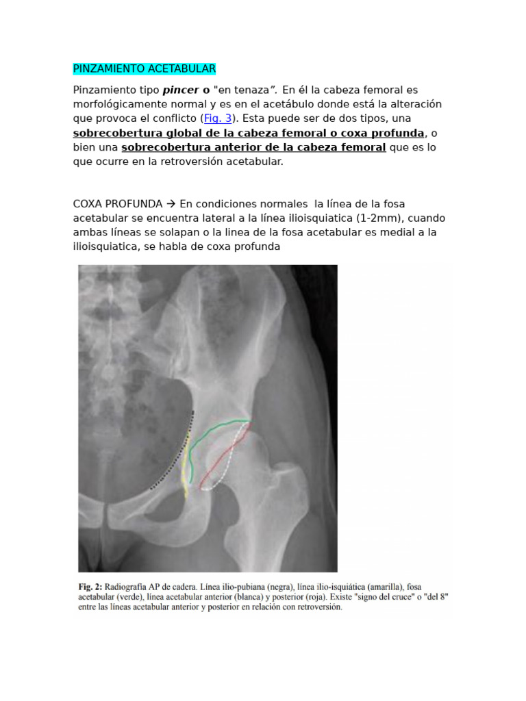 Copia de Pinzamiento Acetabular | PDF | Enfermedades y trastornos ...