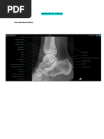 Evaluacion Ecografica de Tobillo | PDF | Tobillo | Pie