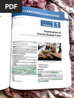 Abnormal Arterial Line Waveforms - Deranged Physiology | PDF | Blood ...