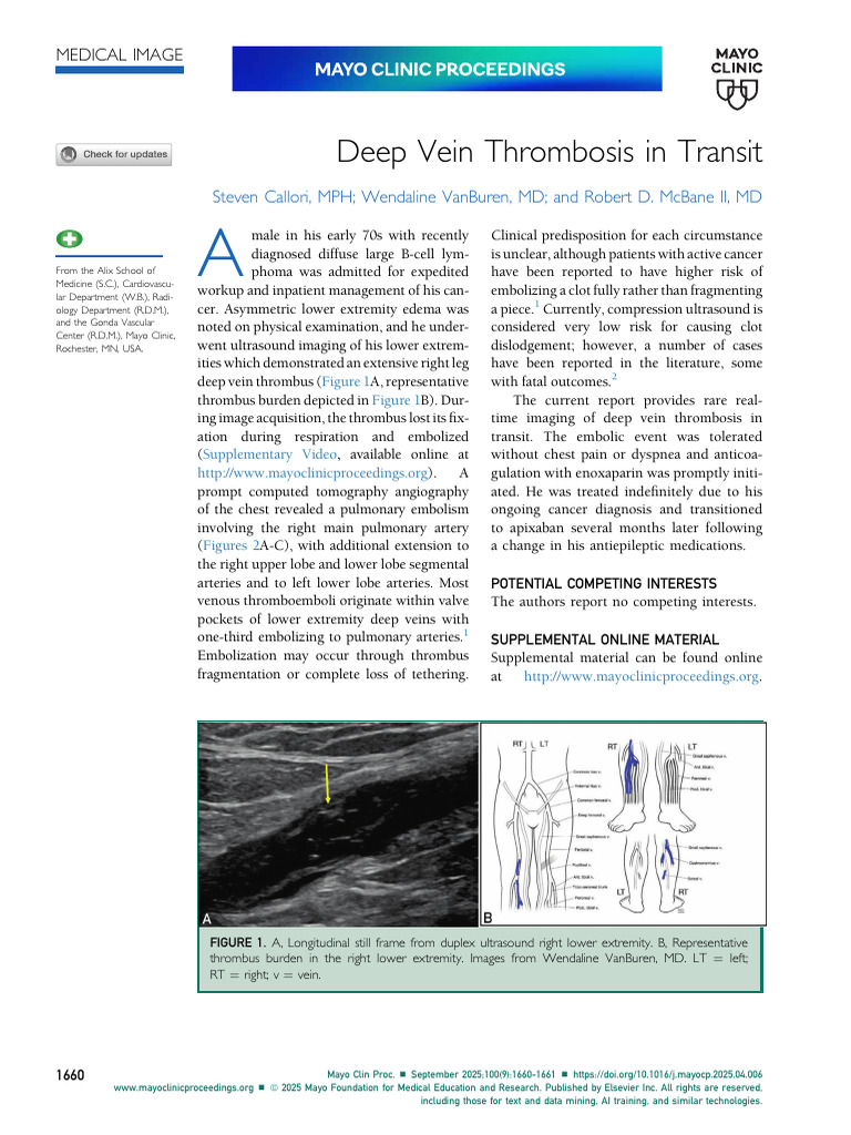 Deep Vein Thrombosis in Transit | PDF | Vein | Thrombosis