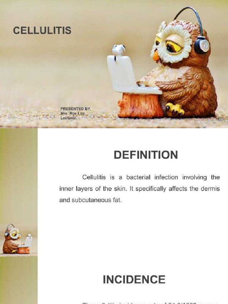 Cellulitis | PDF