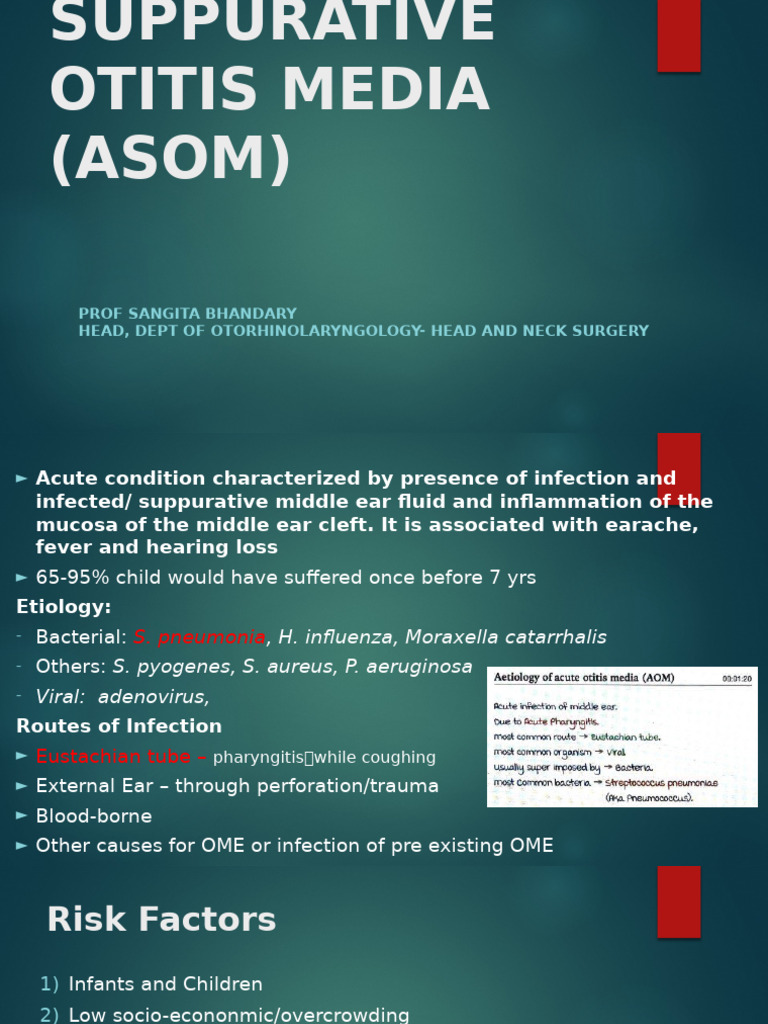 Understanding Suppurative Otitis Media | PDF | Auditory System ...