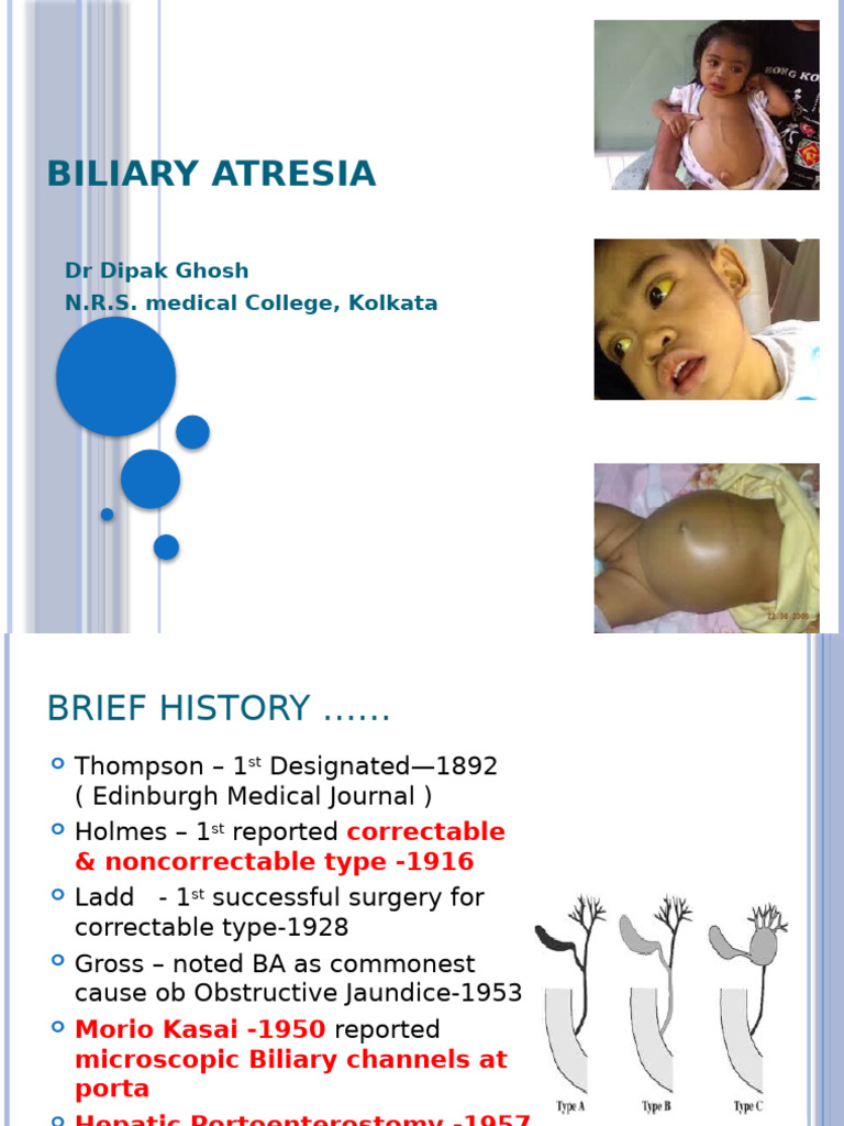 Biliary Atresia Presentation 2 | PDF | Liver | Diseases And Disorders