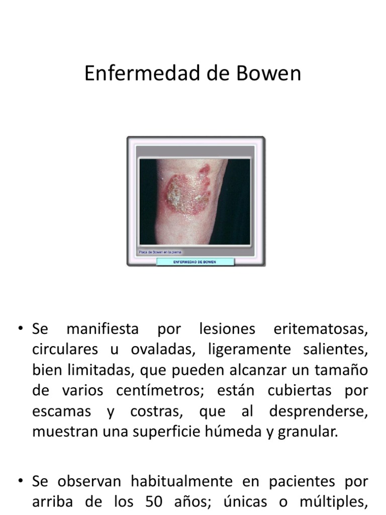Enfermedad de Bowen | PDF | Cáncer | Cirugía