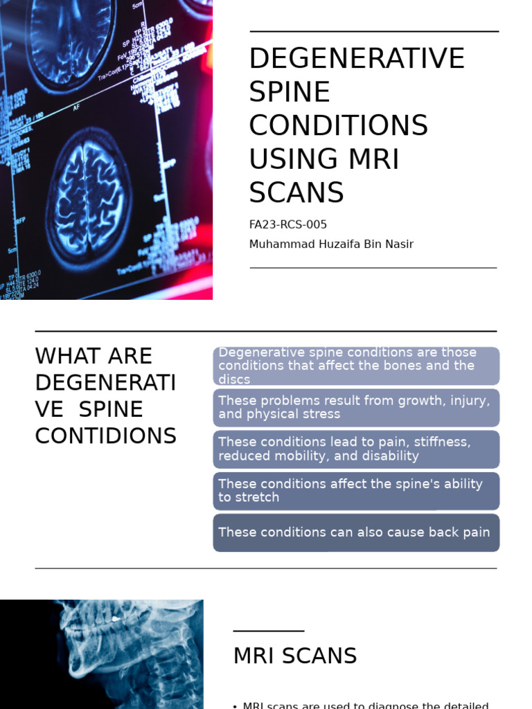 Internal Defense 005 | PDF | Radiology | Magnetic Resonance Imaging