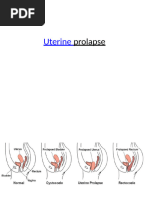PFIQ-7: Pelvic Floor Impact Assessment | PDF | Vagina | Urinary Bladder