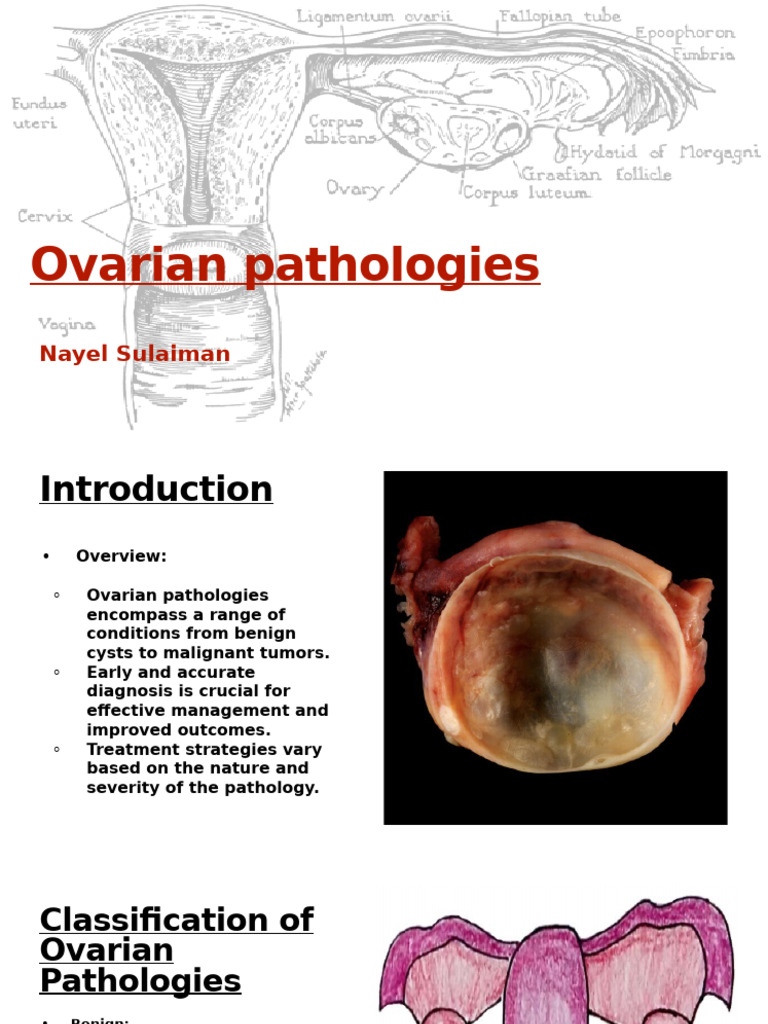 Ovarian Pathologies - Gyn | PDF | Ovarian Cancer | Clinical Medicine