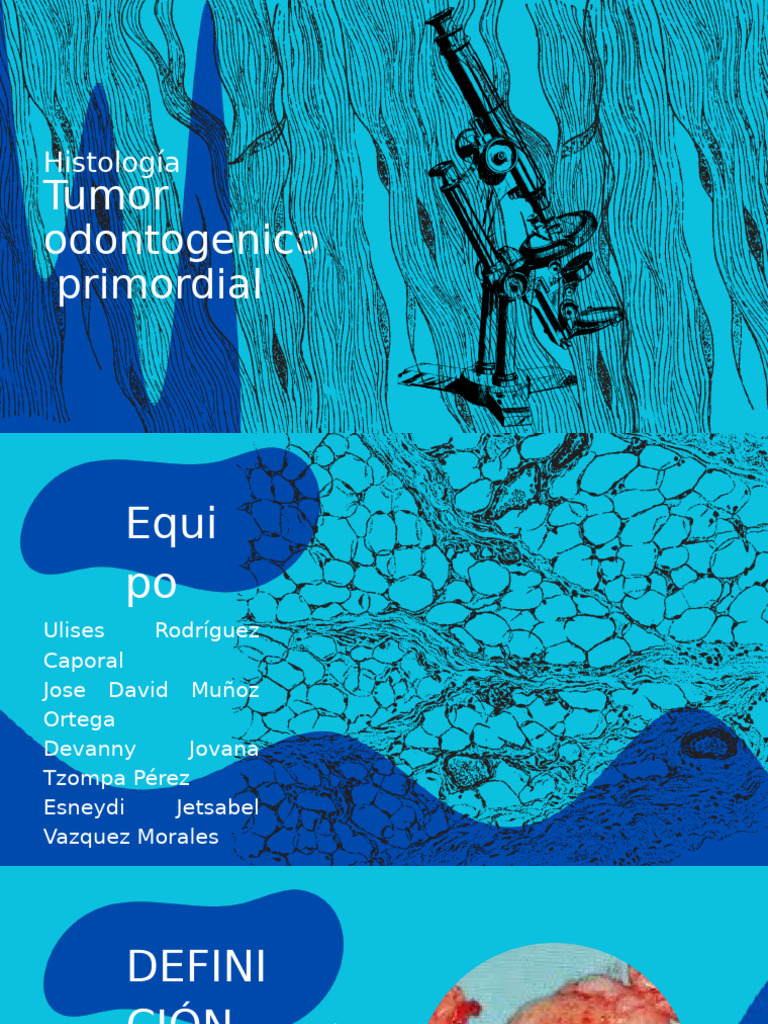 Tumor Odontogénico Primordial: Definición y Características | PDF ...