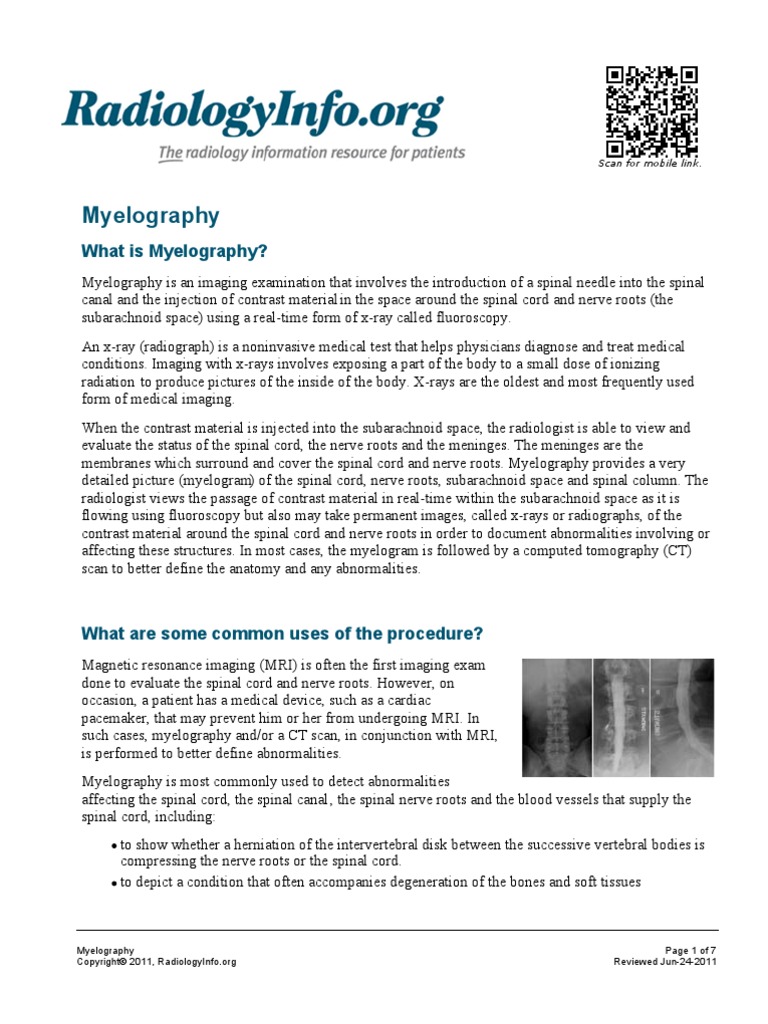 myelography | Radiology | Vertebral Column