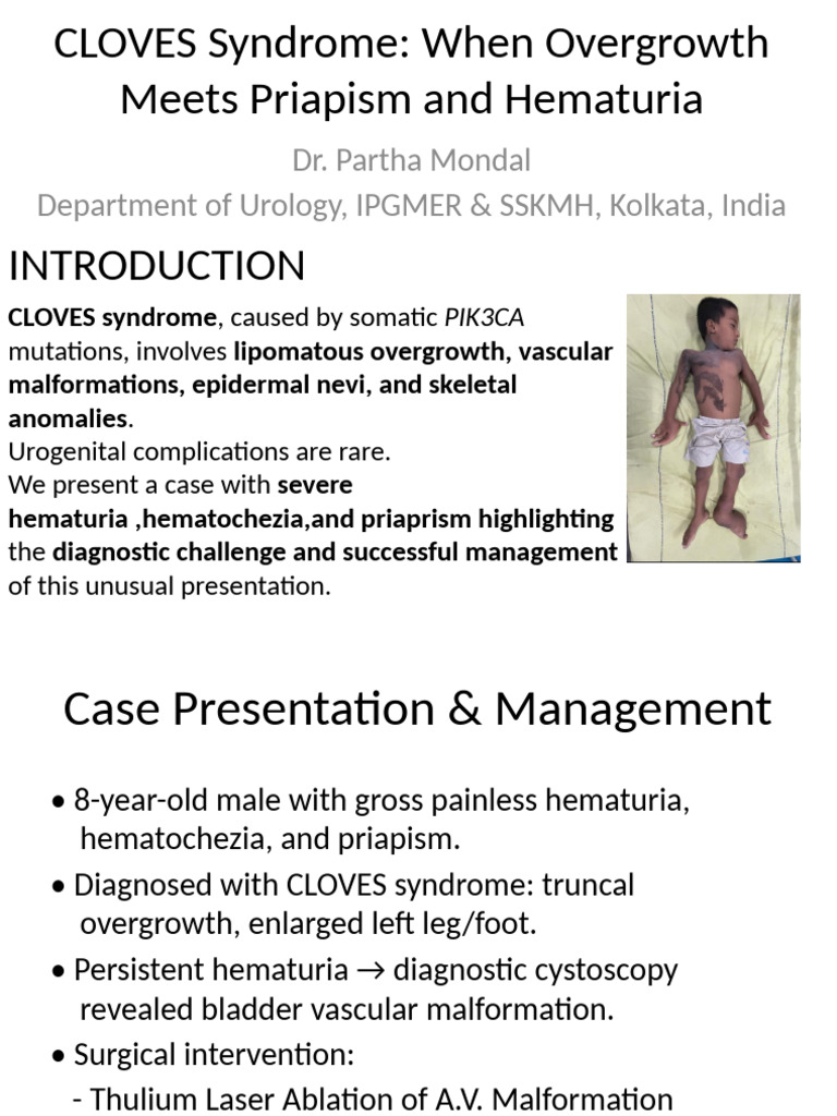 CLOVES Syndrome: Urogenital Complications | PDF