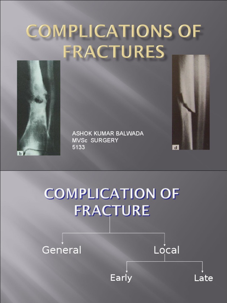 Complications of Bone Fractures | PDF | Bone | Musculoskeletal System