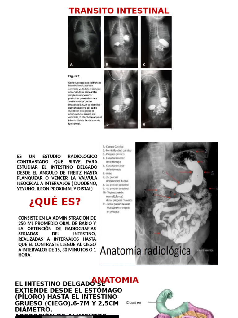 Estudio de Tránsito Intestinal: Proceso y Cuidados | PDF | Tracto ...