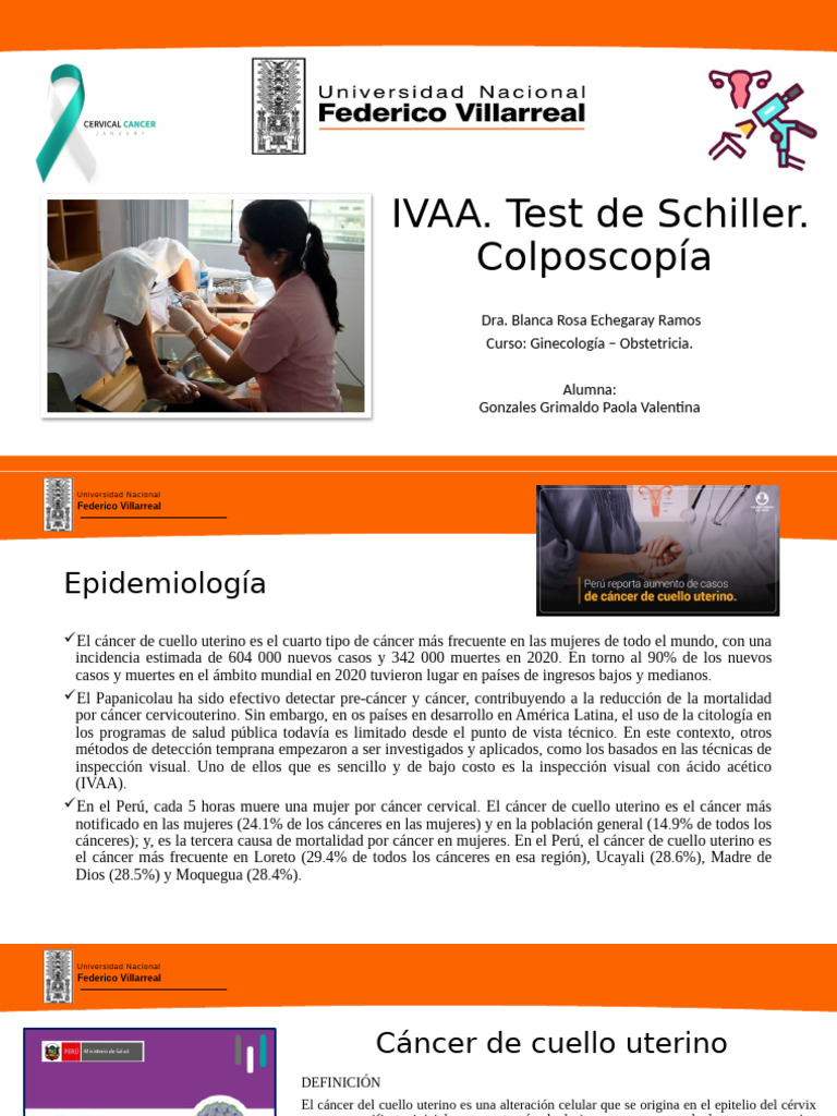 Test de IVAA y Schiller en Cáncer Cervical | PDF | Cáncer de cuello ...