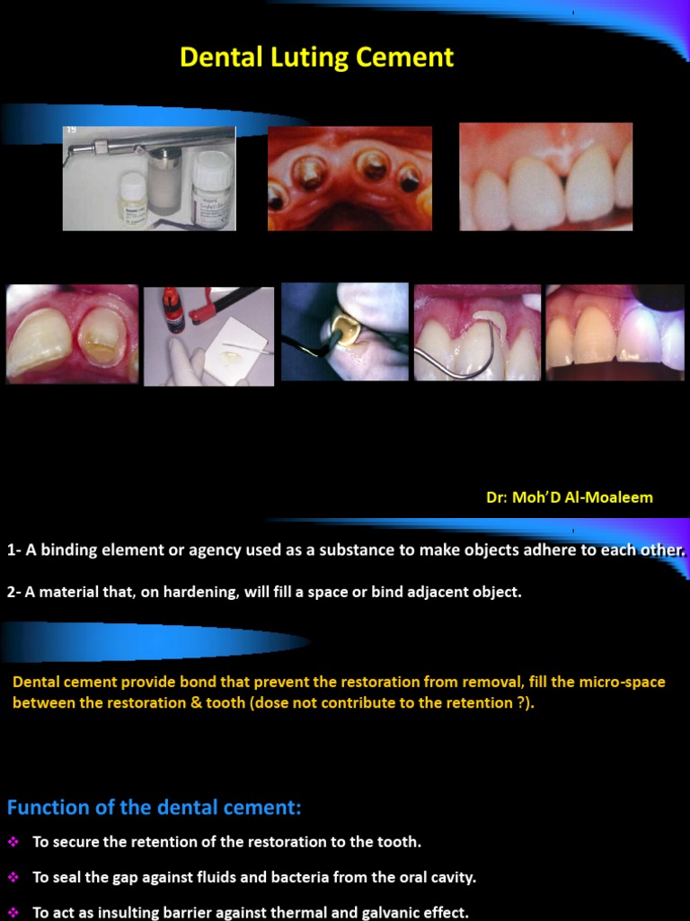 Overview of Dental Luting Cements | PDF