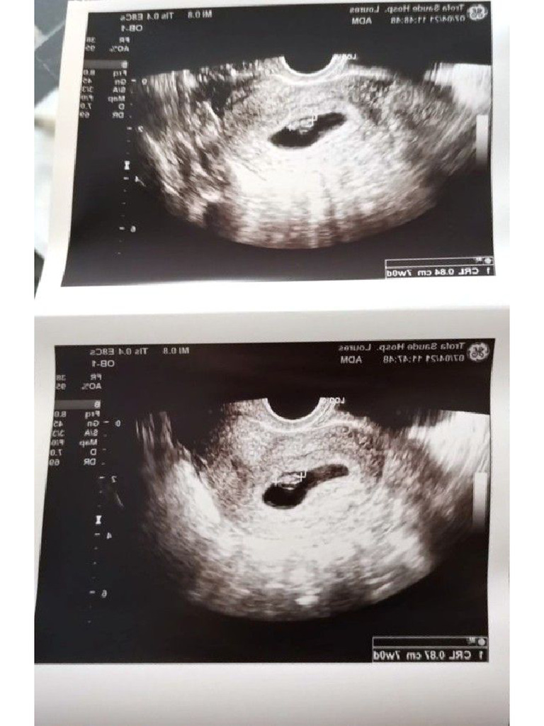 OneRead 20250910 0053 | PDF