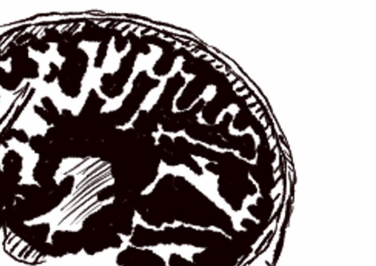 Lobotomy 3 | PDF