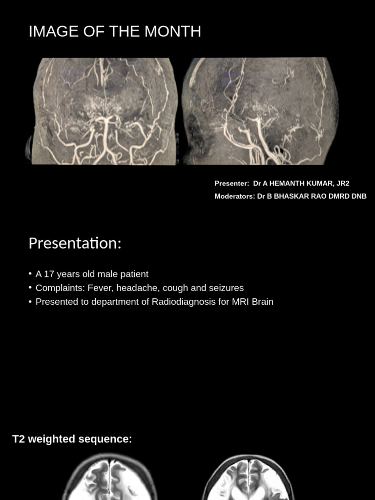 Hemanth Image of The Month Main | PDF | Stroke | Diseases And Disorders