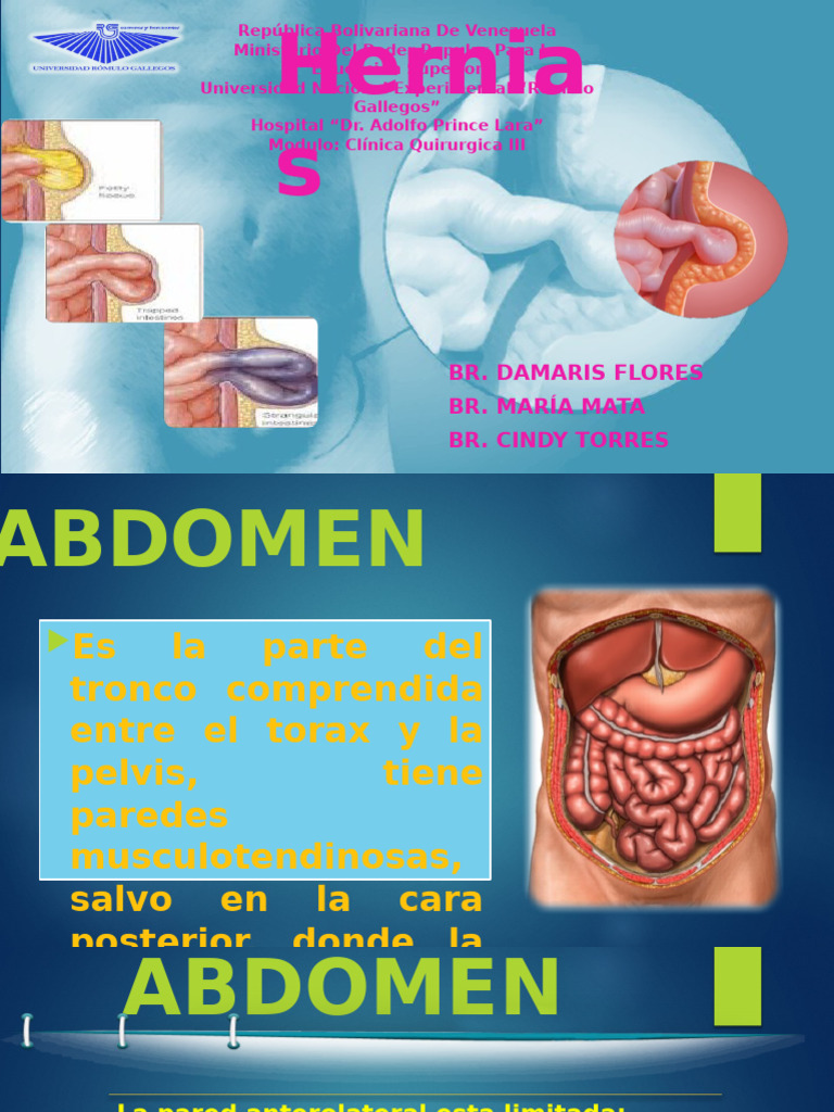 Clasificación y Complicaciones de Hernias | PDF | Abdomen | Pelvis