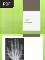 Hand X-Ray Projections Guide | PDF | Hand | Finger