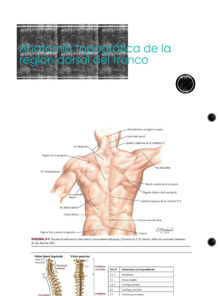 09 Región Dorsal Del Tronco - PPTX - 20250421 - 095328 - 0000 | PDF