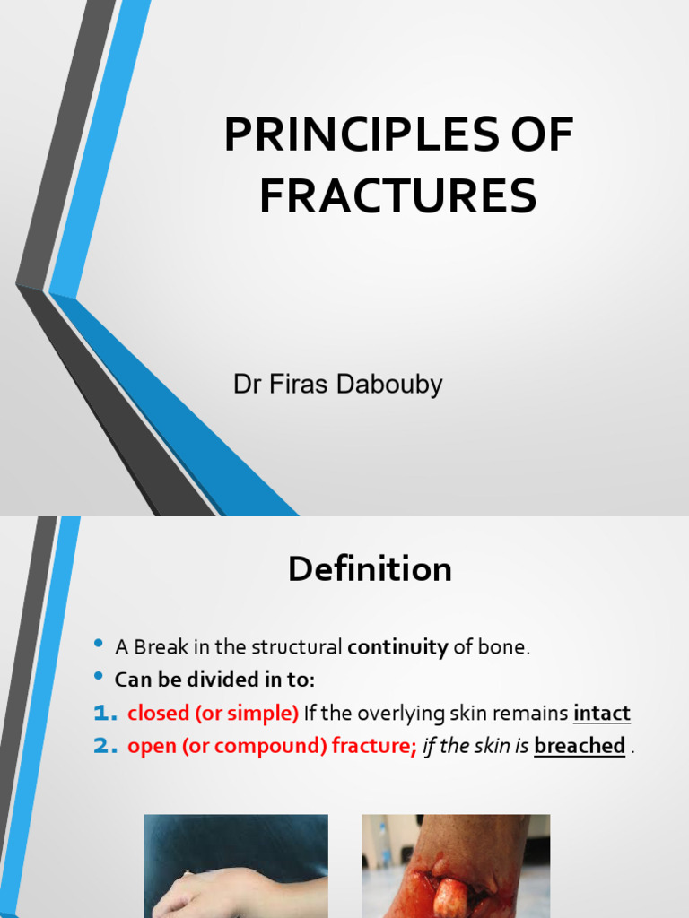 2. Principles of Fractures | PDF | Bone | Healing