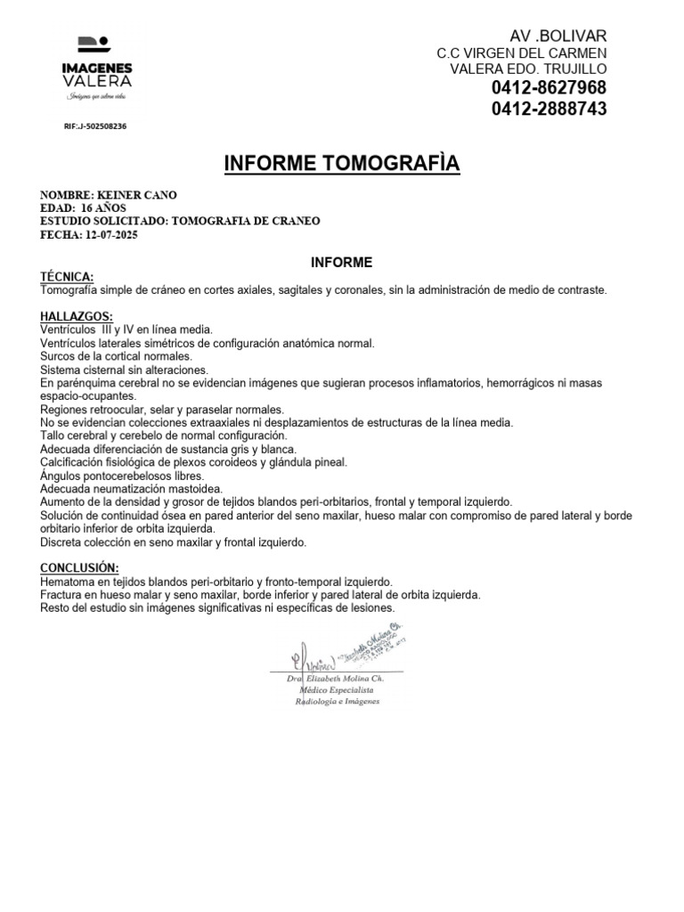 Keiner Cano | PDF