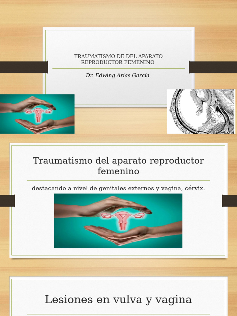 Edwin Arias 02 | PDF | Parto | Vagina