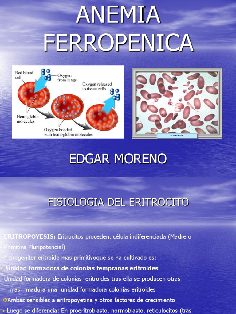 30. Anemia Ferropenica | Glóbulo rojo | Anatomía