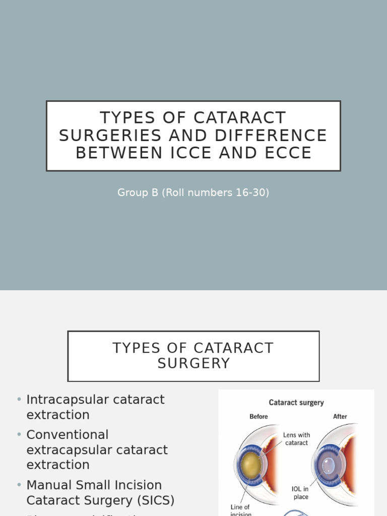 ICCE vs ECCE: Cataract Surgery Overview | PDF | Cataract | Medical ...