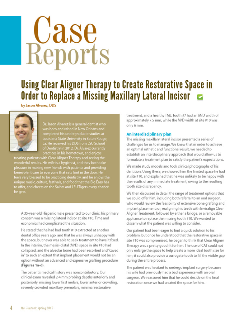 Create Restorative Space in Order To Replace A Missing Uppper Lateral ...