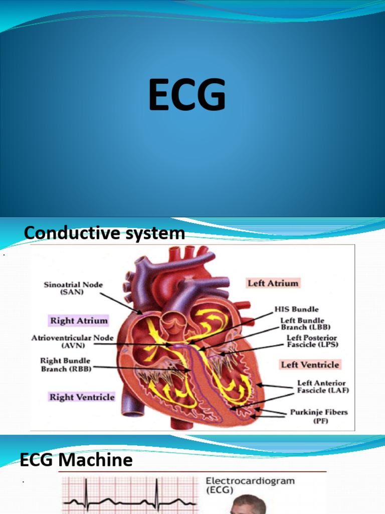 ECG Electrocardiogram | PDF