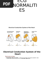ECG Rhythm Interpretation | PDF | Electrocardiography | Cardiology