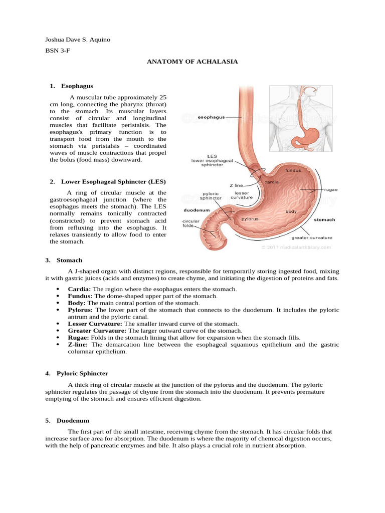 Anatomy of Achalasia | PDF | Stomach | Esophagus