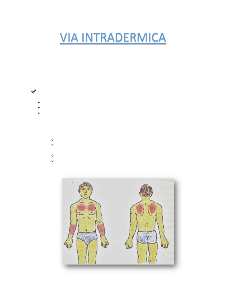 Via Intradermica y Subcutanea | PDF | Inyección (medicina) | Medicina ...