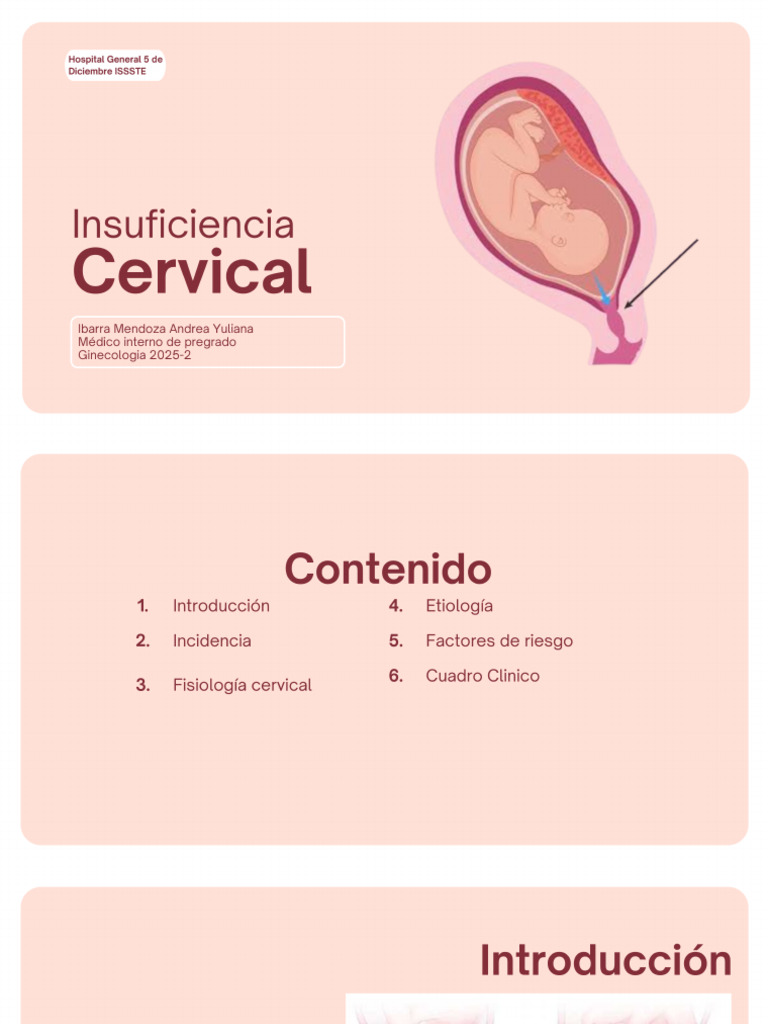 Incompetencia Cervical PDF | PDF