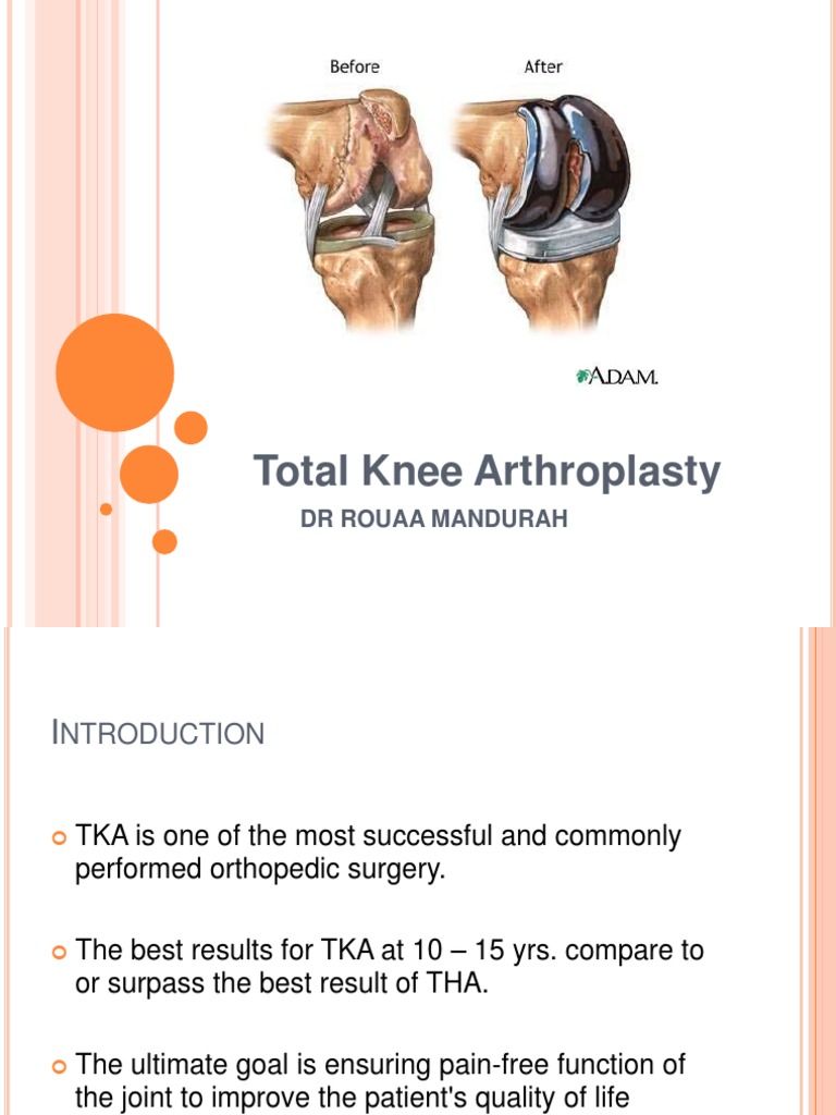 Total Knee Arthroplasty Guide | PDF | Knee | Limbs (Anatomy)