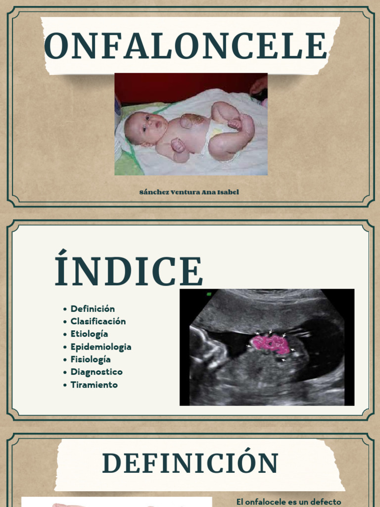 Onfalocele: Definición y Tratamiento | PDF | Abdomen | Parto