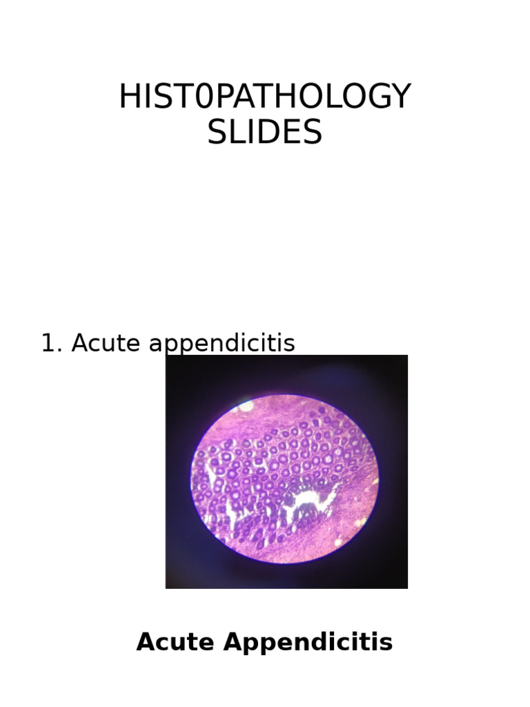 Histopathology and Cytology Slide Analysis | PDF | White Blood Cell ...