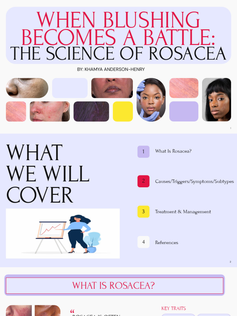 When Blushing Becomes A Battle - The Science of Rosacea | PDF ...