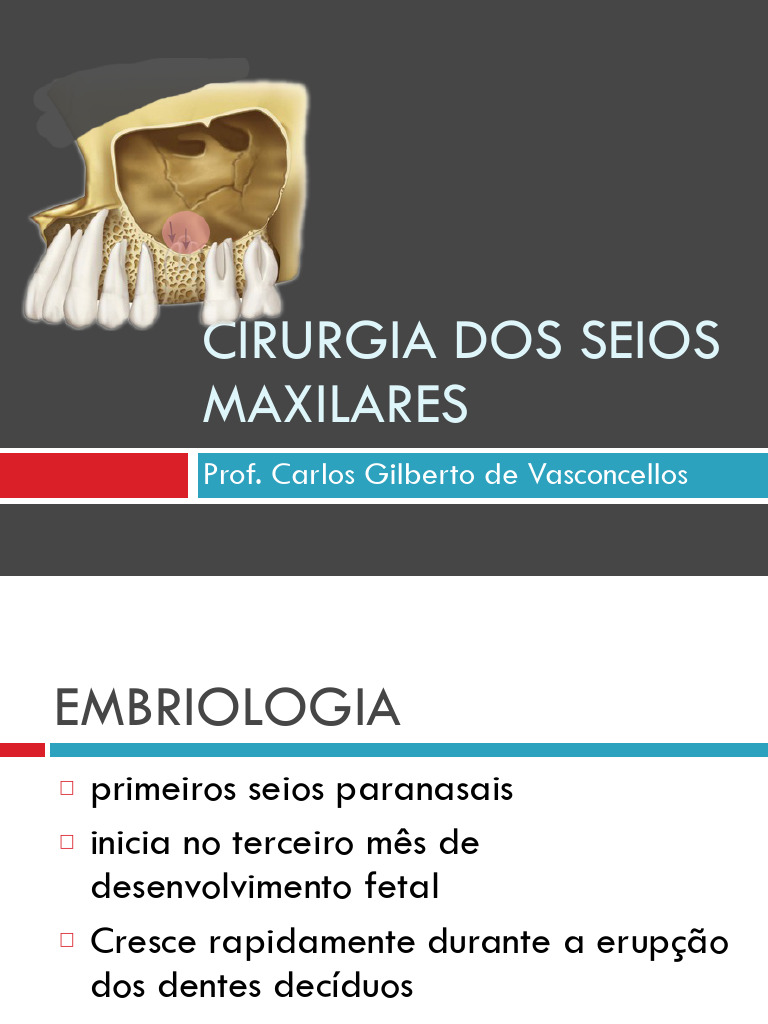 PDF Cirurgia Do Seio Maxilar | PDF | Especialidades médicas