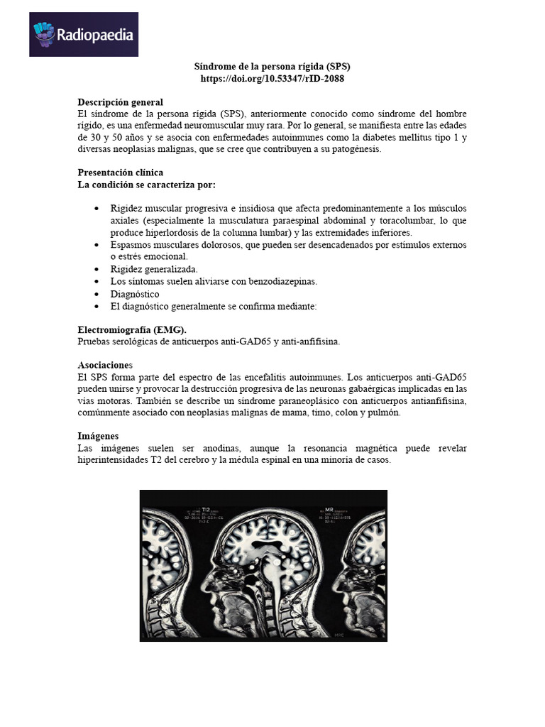 Síndrome de la Persona Rígida: Guía Completa | PDF | Medicina CLINICA ...