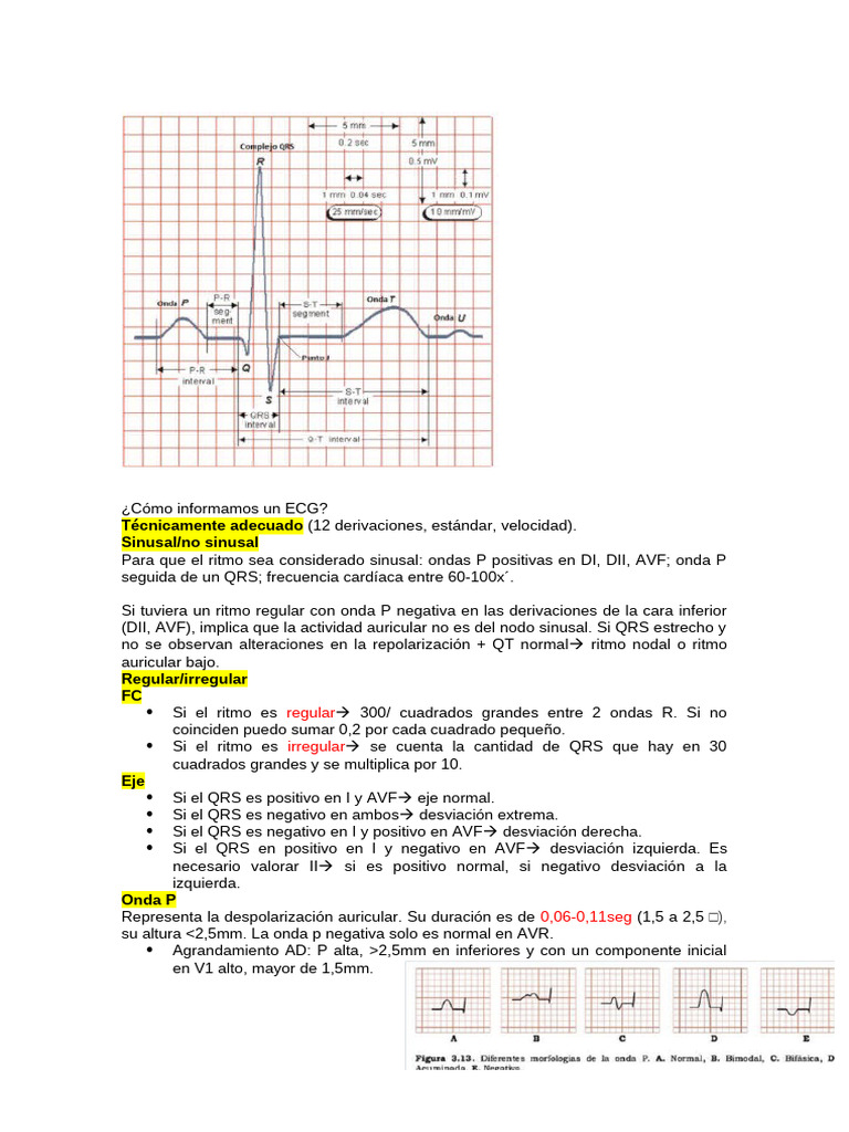 Cómo Informamos Un ECG | PDF | Medicina Interna | Electrofisiologia