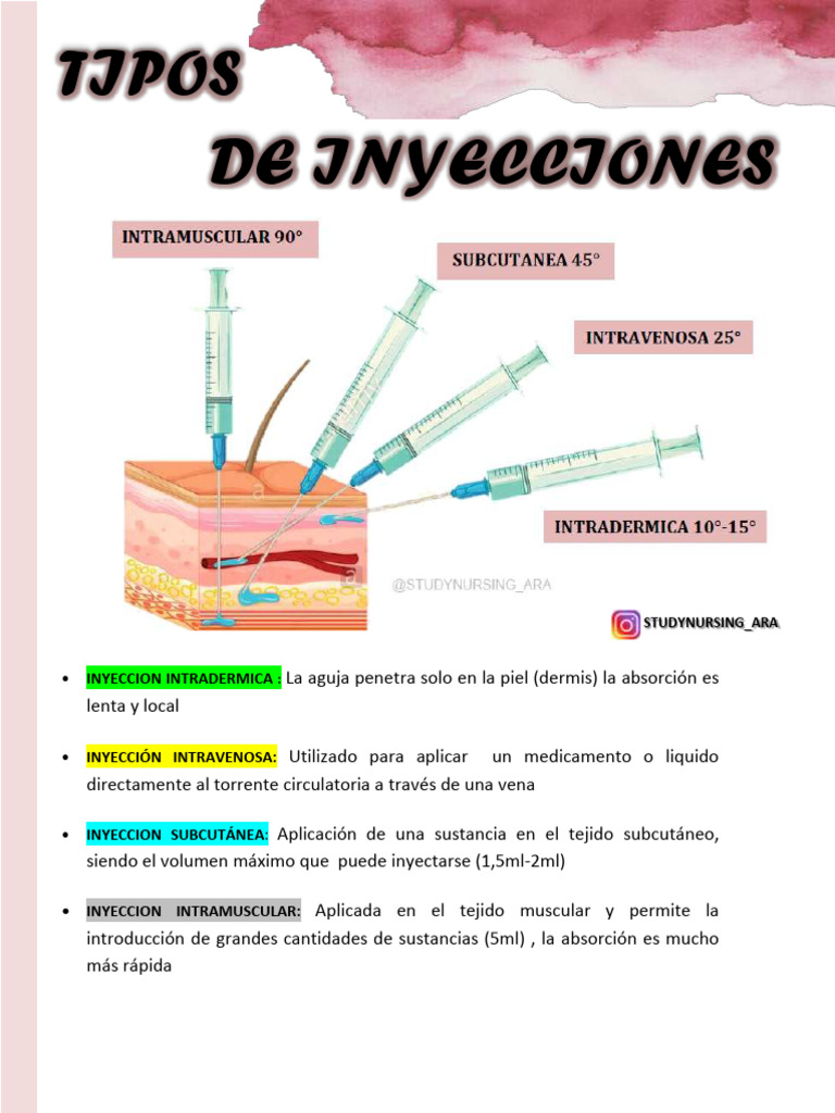 Tipos de Inyecciones 1 | PDF