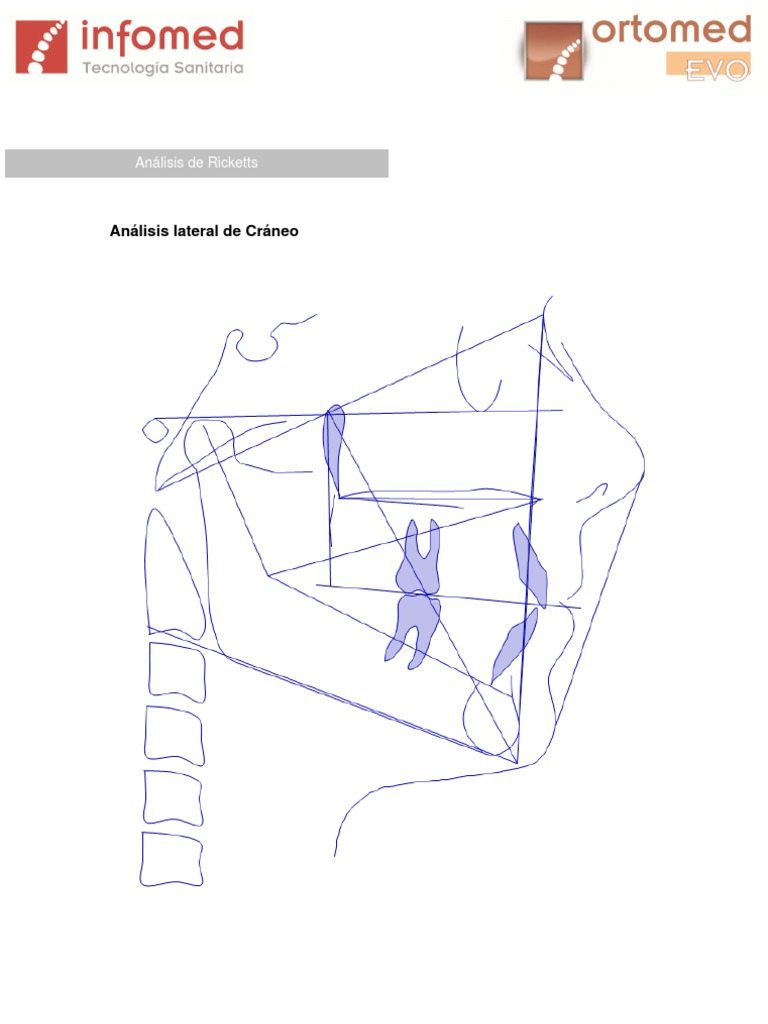 Analisis de Ricketts | PDF