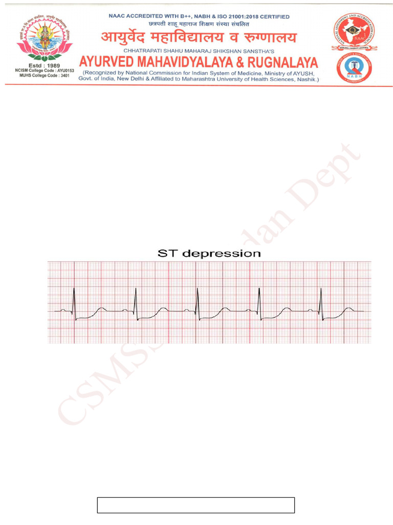ECG Project Club File-Roll No-14 | PDF