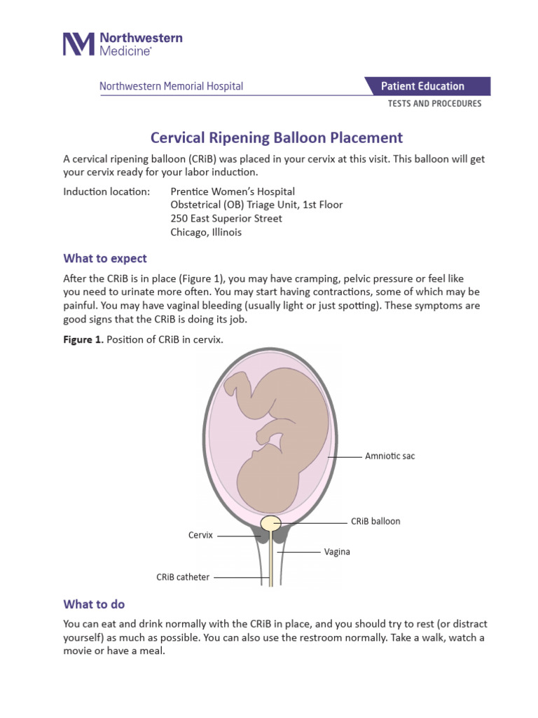 Cervical Ripening Balloon Guide | PDF | Childbirth | Health Care
