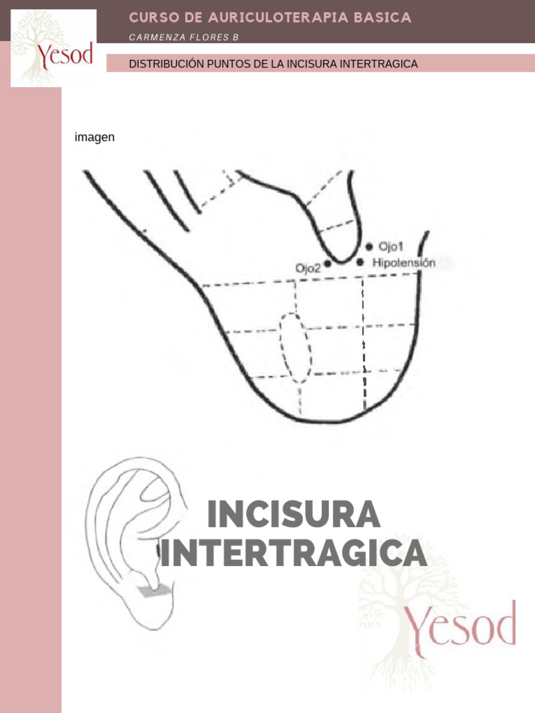 49-B-Puntos de La Incisura Intertragica | PDF